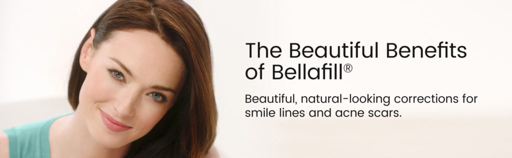 Bellafill NYC | Bellafill Treatment | Dermal Filler Treatment