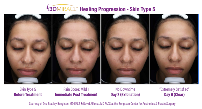 UltraClear™ Laser Treatment NYC | Dagan MD Facial Plastic Surgery